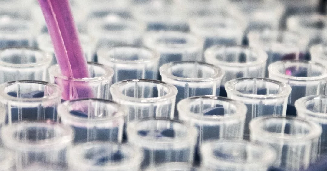 Kan je prostaatkanker ontdekken met een urinetest? | Andros Clinics