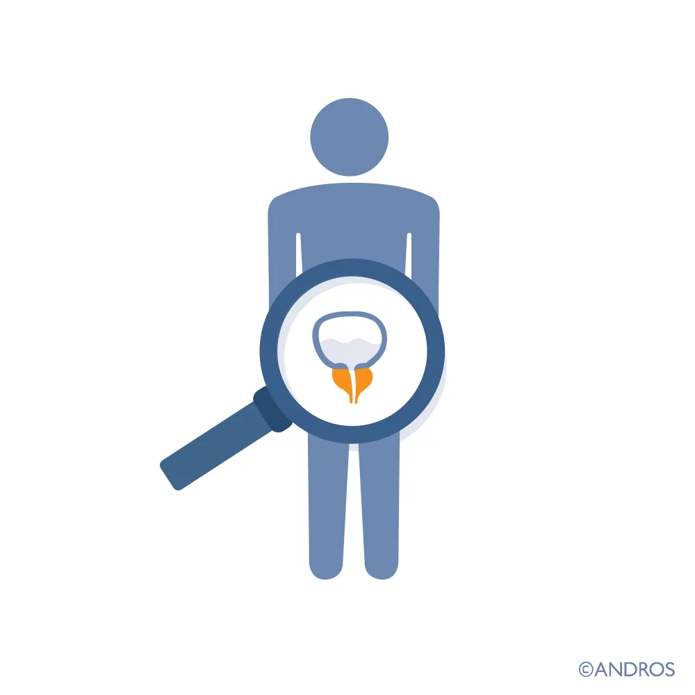 Kan je zelf je prostaat checken? - Andros Clinics