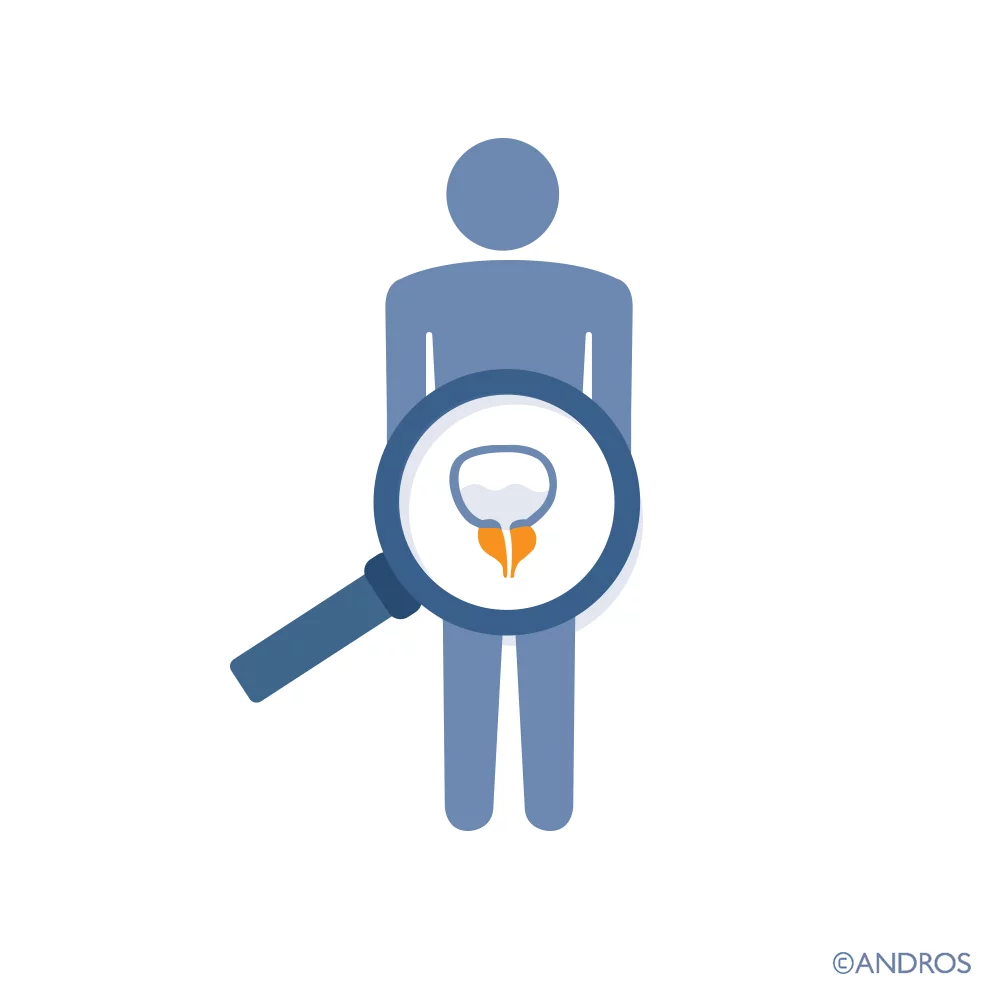 Check uw risico op prostaatkanker in 30 seconden | Andros Clinics